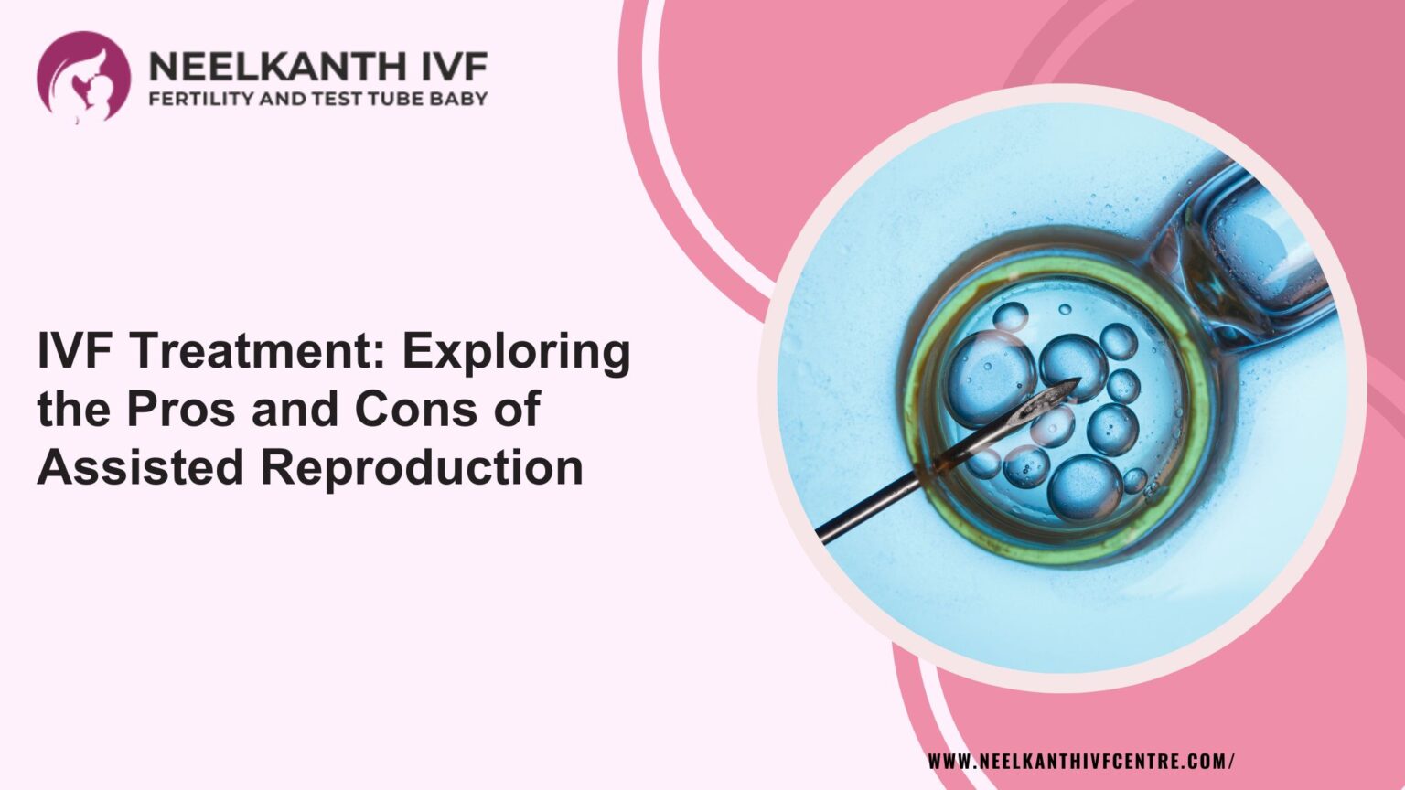 IVF Treatment: Exploring The Pros And Cons Of Assisted Reproduction