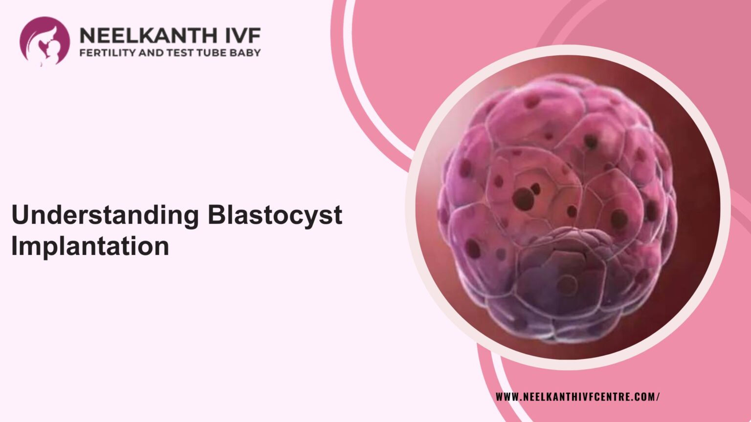Understanding Blastocyst Implantation - Neelkanth IVF