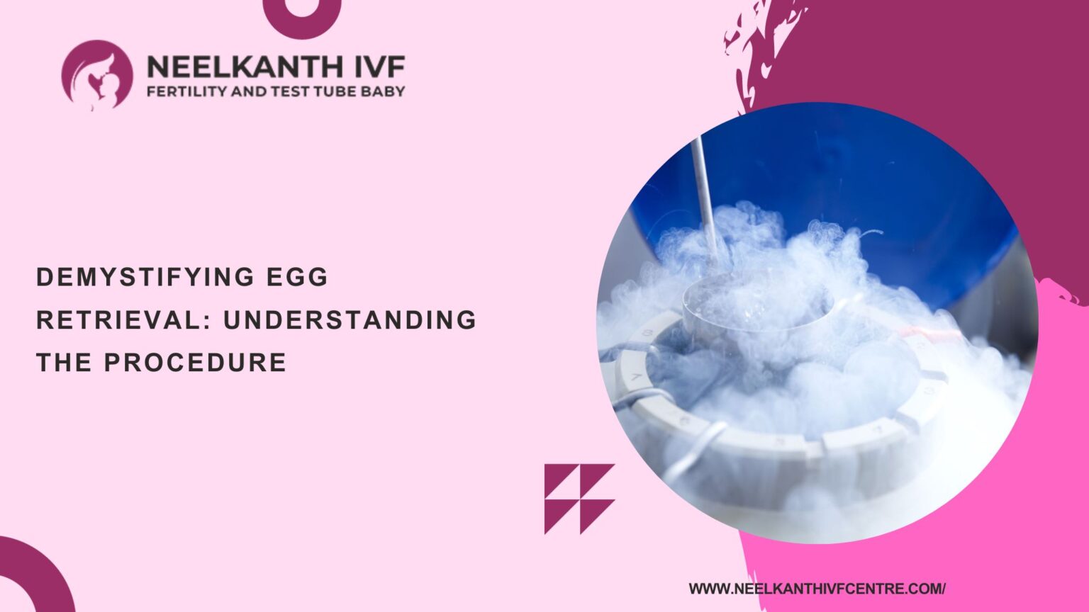 Demystifying Egg Retrieval: Understanding The Procedure