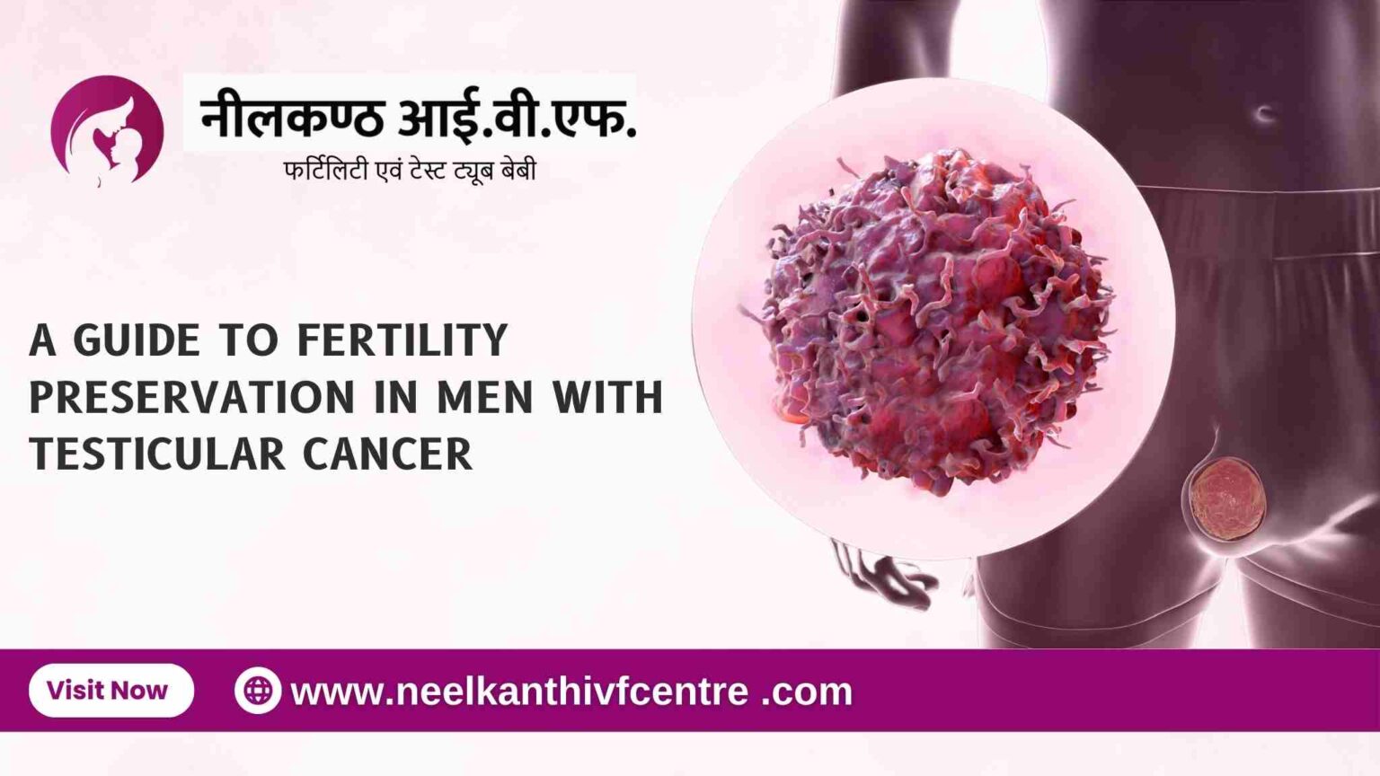 A Guide To Fertility Preservation In Men With Testicular Cancer ...