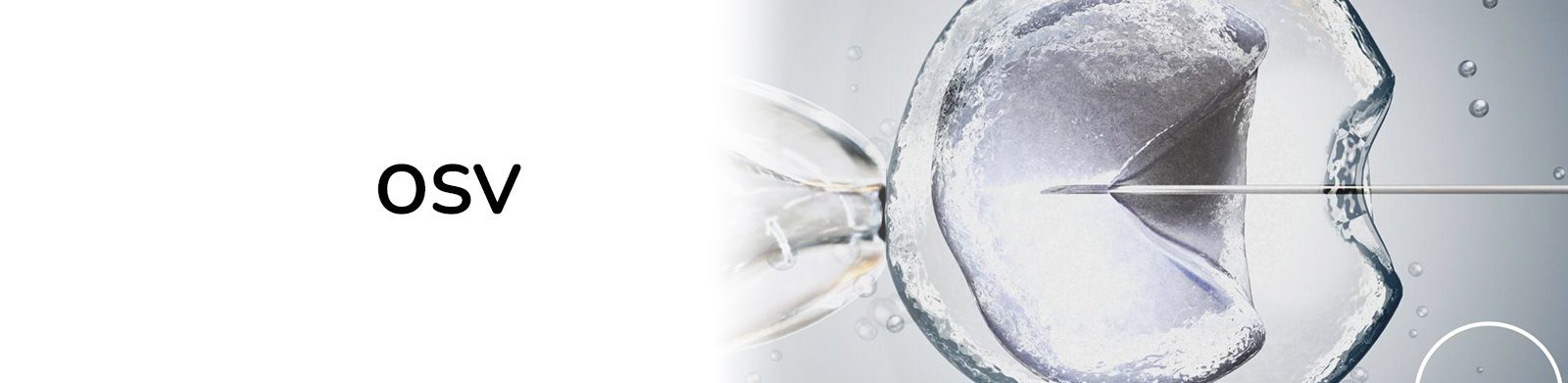 OSV Oosight Spindle View - Neelkanth IVF Centre