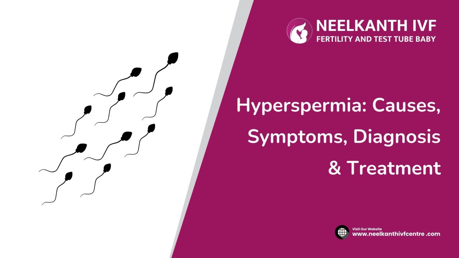 Hyperspermia: Causes, Symptoms, Diagnosis & Treatment