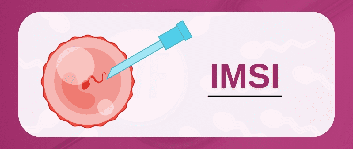 IMSI Intra Cytoplasmic Morphologically Selected Sperm Injection